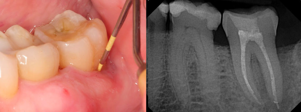 Our Philosophy – Perio Peak